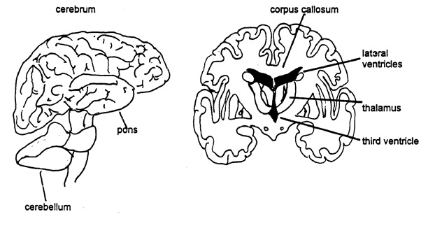 Factsheet about Cranial Nerve Abnormalities « Charge Syndrome Foundation
