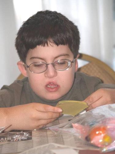 Cleft Lip +/- Cleft Palate « Charge Syndrome Foundation